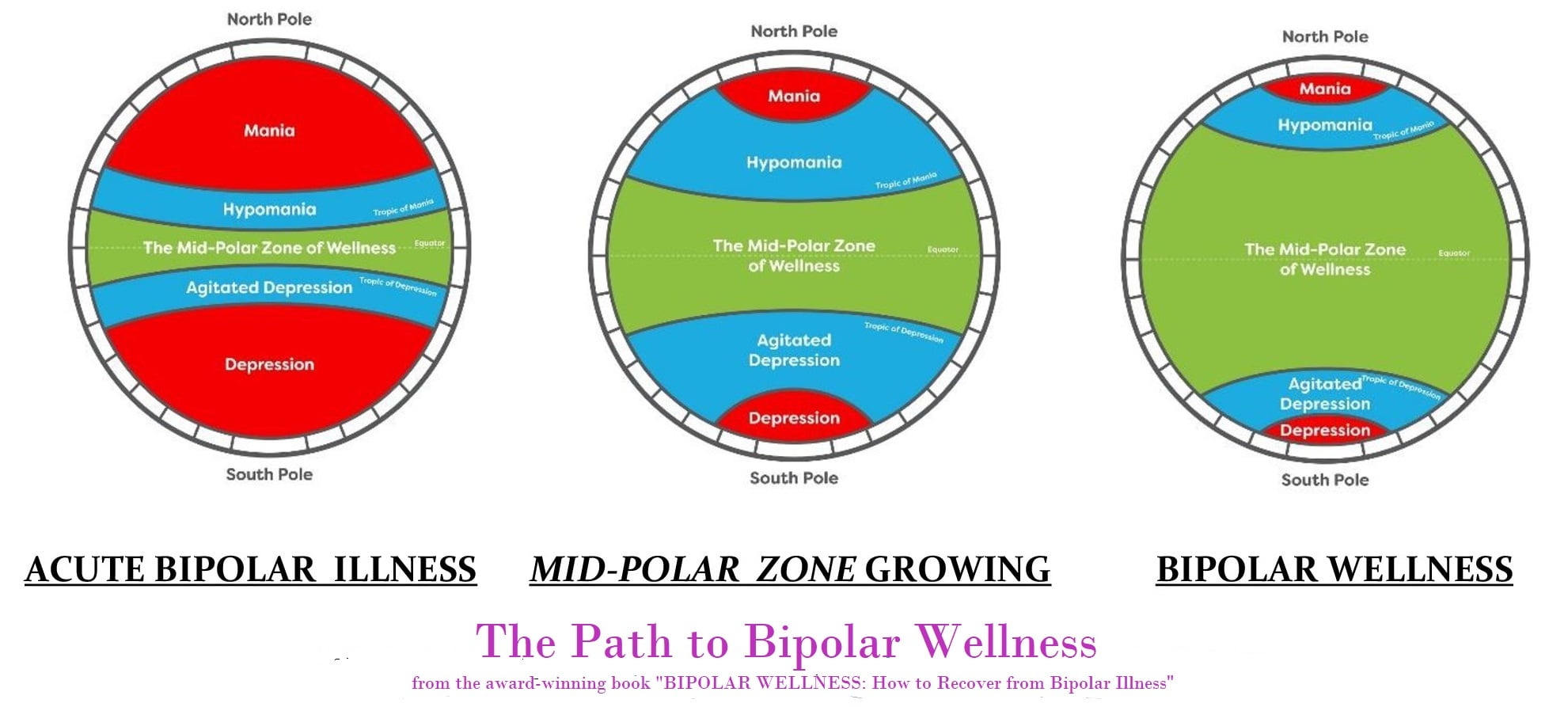Coaching 4 week Program - Bipolar Wellness